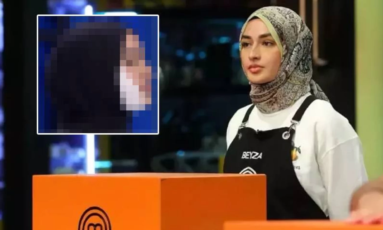 MasterChef Beyza'nın son hali nasıl? Beyza'nın yüzünde iz kalacak mı ...