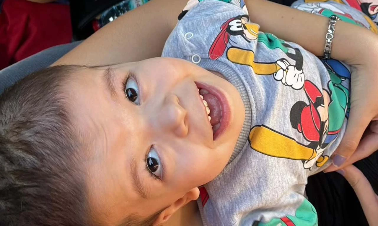 Ali Aras kimdir, neden öldü? Akondroplazi cücelik hastalığı nedir ...